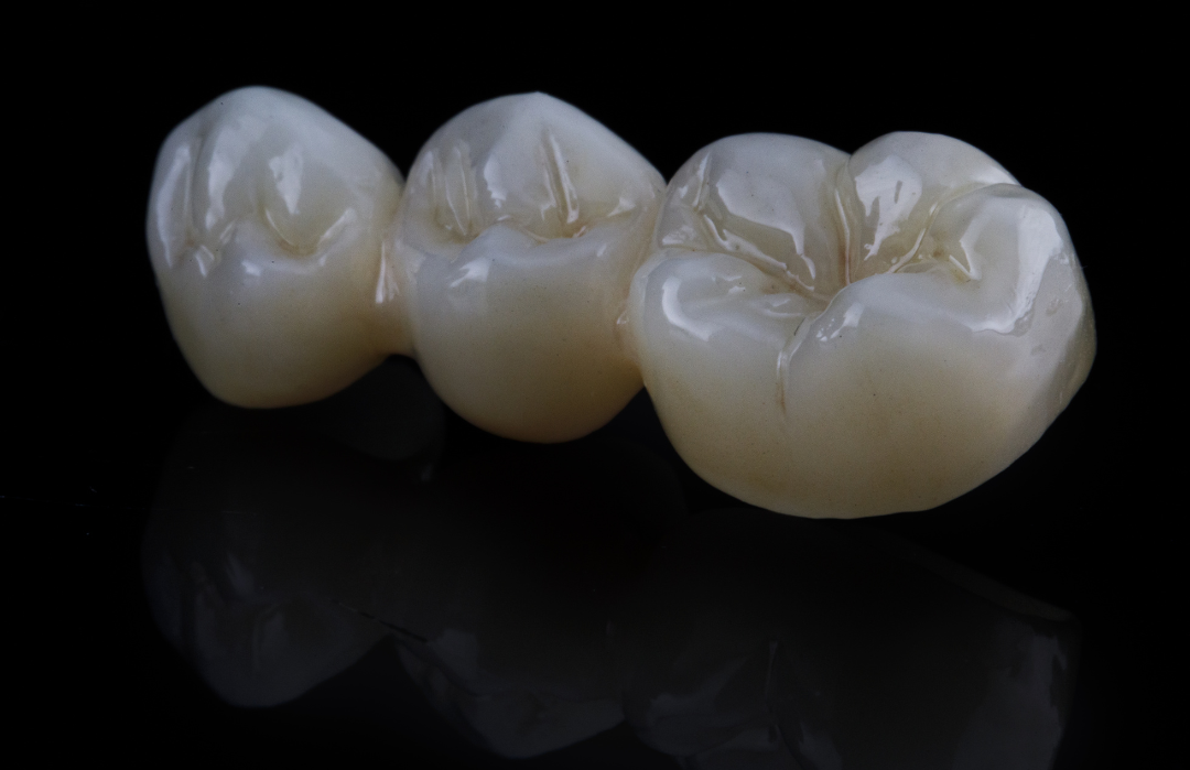 Zirconia Crown - Point Dental Algodones